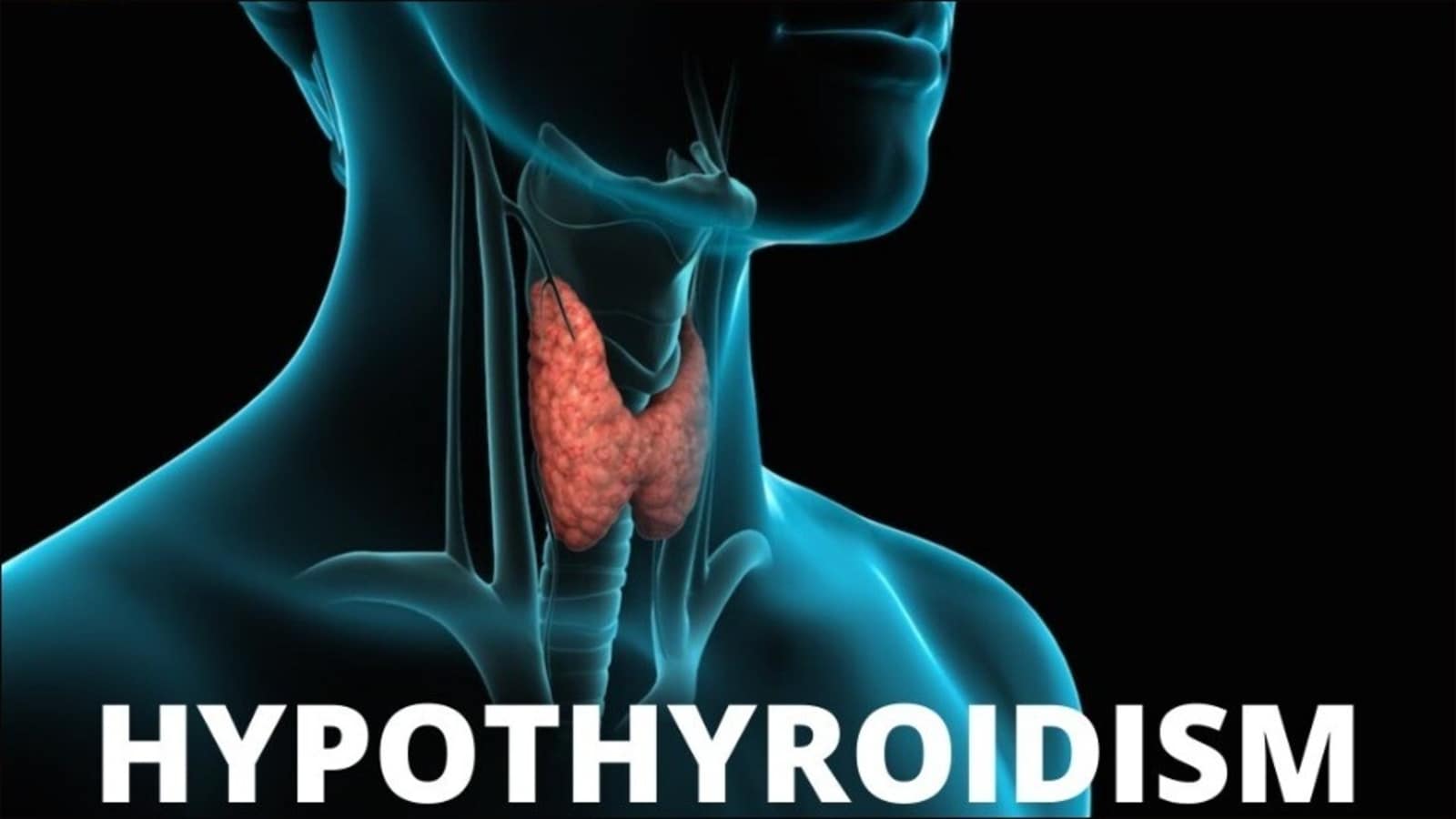 Hypothyroidism Common Myths And Facts Myarogya